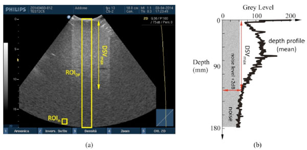 A Comparative Study on the Influence of Probe Placement on Quality ...