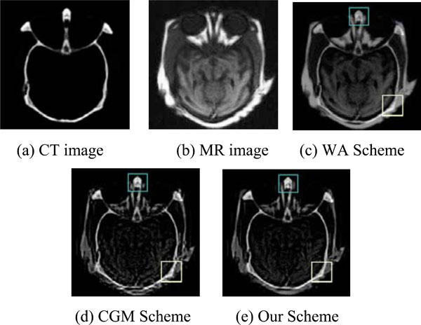 Medical Images Fusion with Patch Based Structure Tensor ~ Fulltext