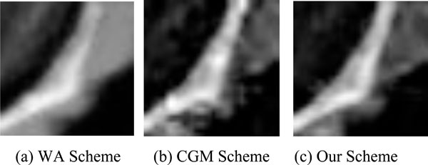 Medical Images Fusion with Patch Based Structure Tensor