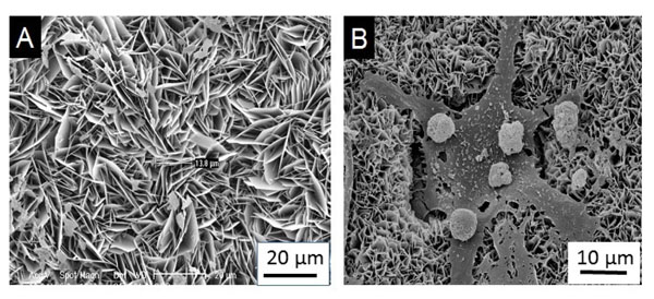 A Review Paper on Biomimetic Calcium Phosphate Coatings