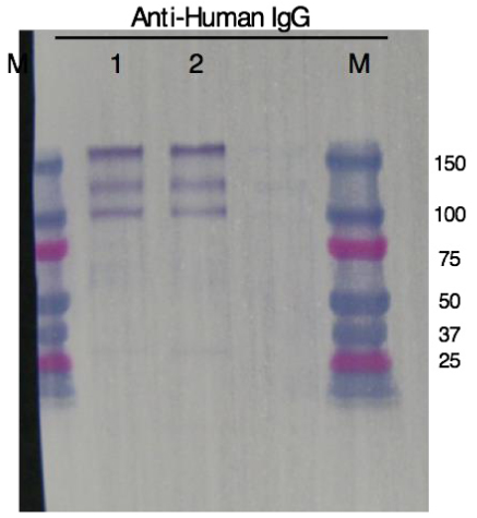 Enhancement of Recombinant Antibody Expression Level by Growth ...