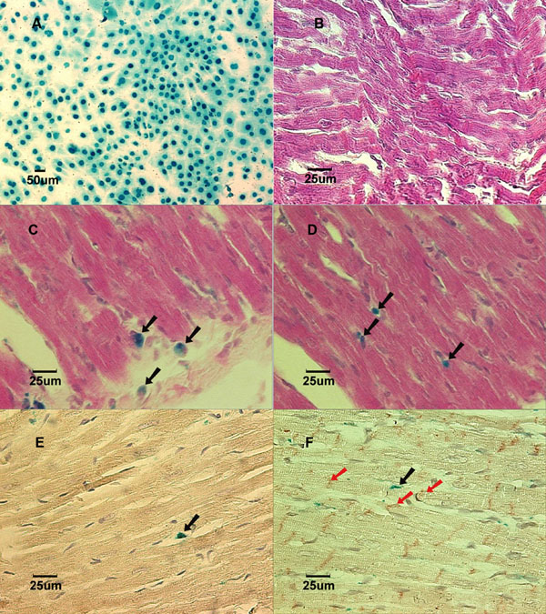 The Immature Heart: The Roles of Bone Marrow Stromal Stem Cells in ...