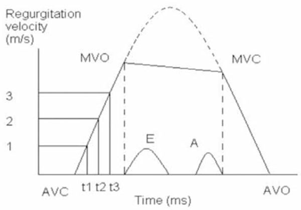 Calculation of Left Ventricular Relaxation Time Constant-Tau in ...
