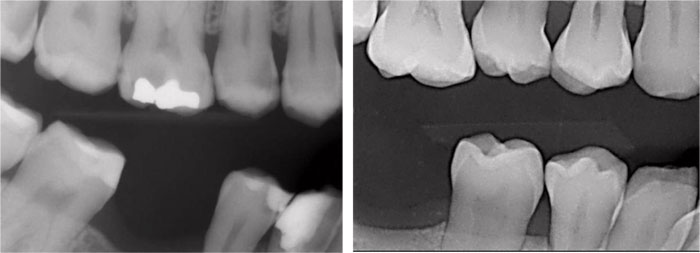 Effects of Consuming Catha Edulis Forsk (khat) on the Gene ...