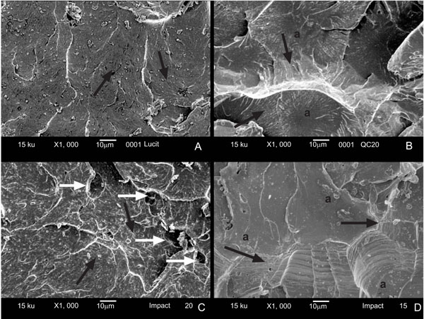 Impact and Flexural Strength, and Fracture Morphology of Acrylic Resins ...