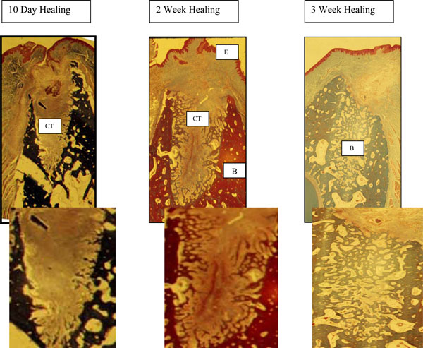 Clinical and Histological Comparison of Extraction Socket Healing ...