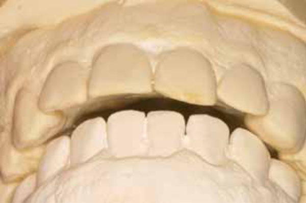 Interdisciplinary Trauma Management in an Elderly Patient, A Case Report