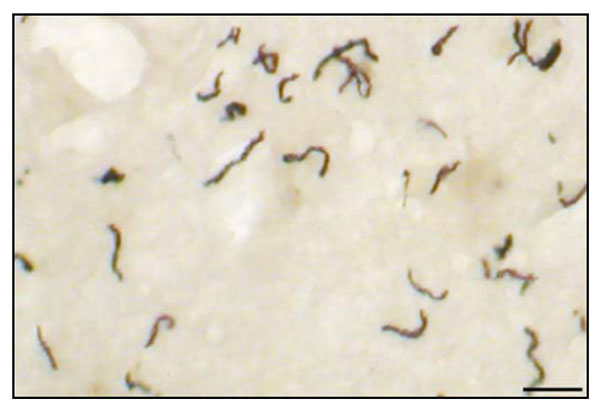 Treponema Pallidum Under Microscope