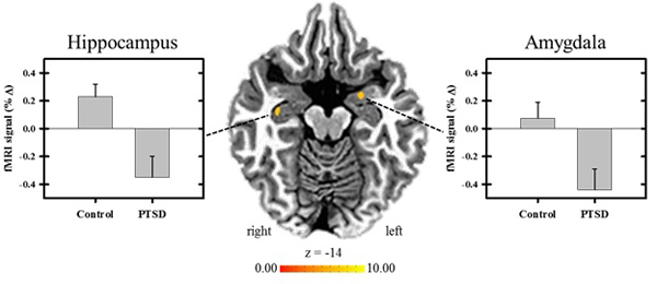 Exploring the Neurocircuitry Underpinning Predictability of Threat in ...