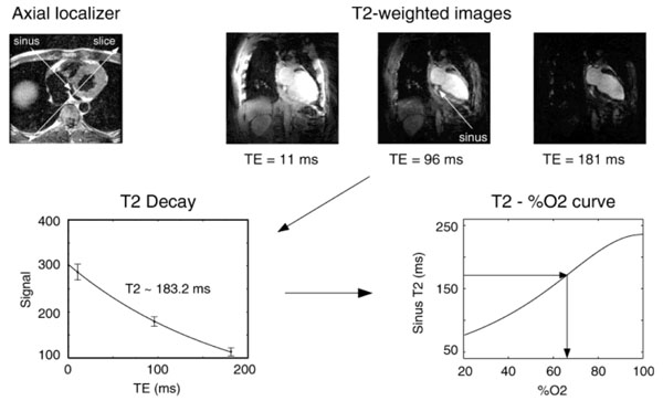 Absolute Oxygenation Metabolism Measurements Using Magnetic Resonance
