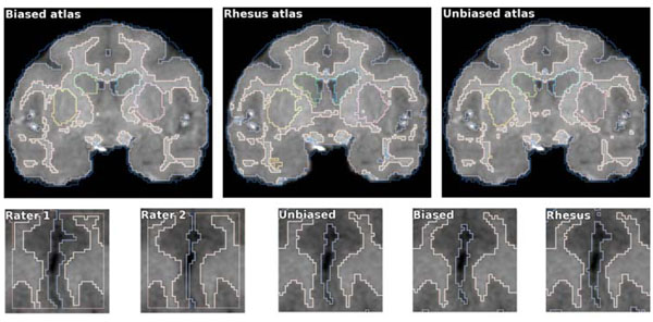 Atlas-Guided Segmentation of Vervet Monkey Brain MRI