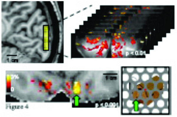High-Field fMRI for Human Applications: An Overview of Spatial ...