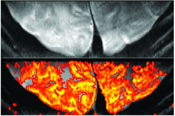 High-Field fMRI for Human Applications: An Overview of Spatial ...