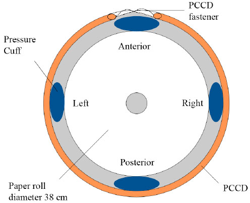 Measurements of the Exerted Pressure by Pelvic Circumferential ...