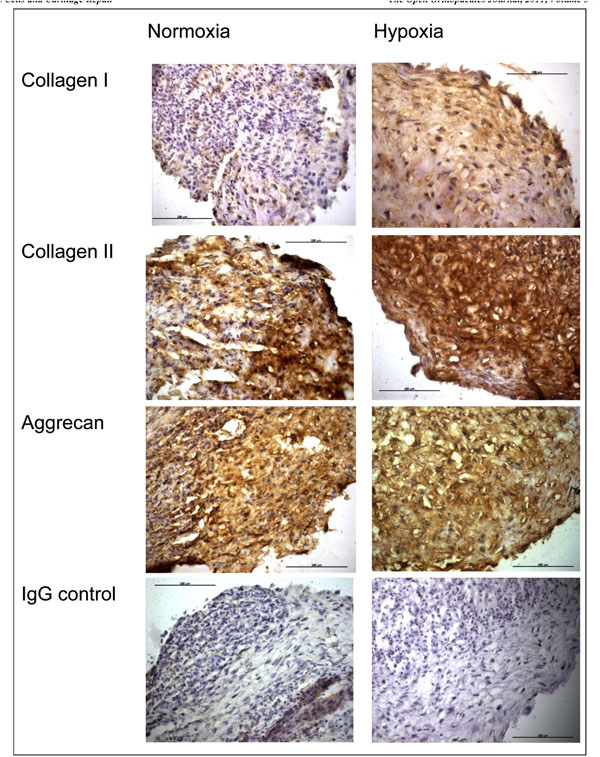 Mesenchymal Stem Cells and Articular Cartilage Repair: Clinical Studies ...