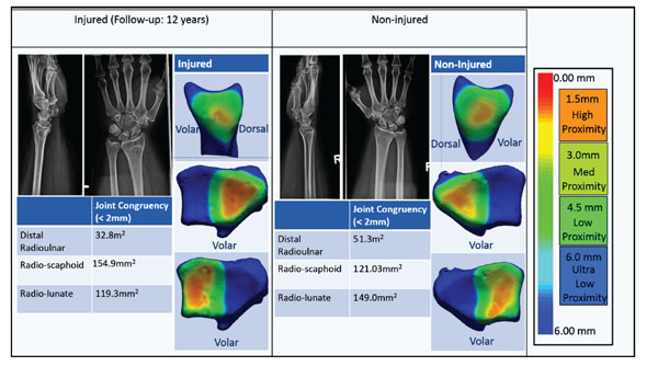 Evaluation of an Image-Based Tool to Examine the Effect of Fracture ...