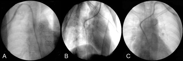 LEARNING FROM IMAGES Guidewire Position as a Guide to the Appropriate ...