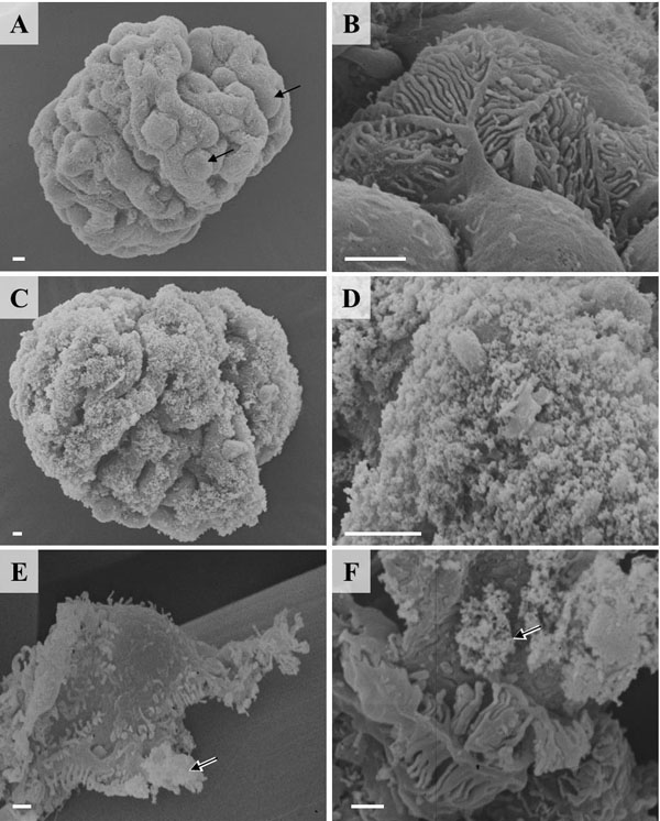 Isolation of Glomerular Podocytes by Cationic Colloidal Silica-coated ...